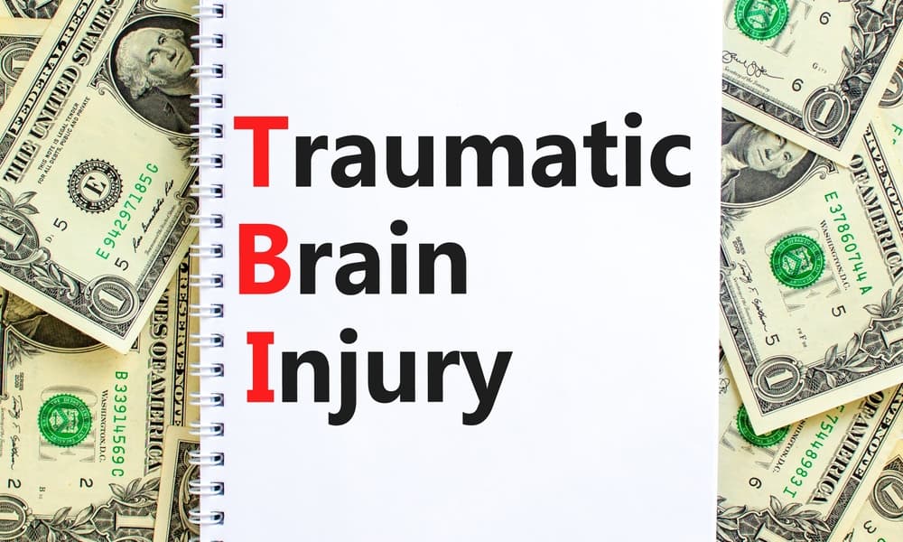 How Are TBI Settlements Calculated | Marcus & Mack